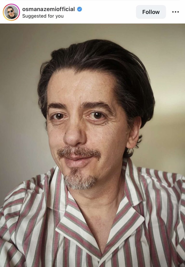 This is what Osman Azemi looks like after the accident, he has changed ...